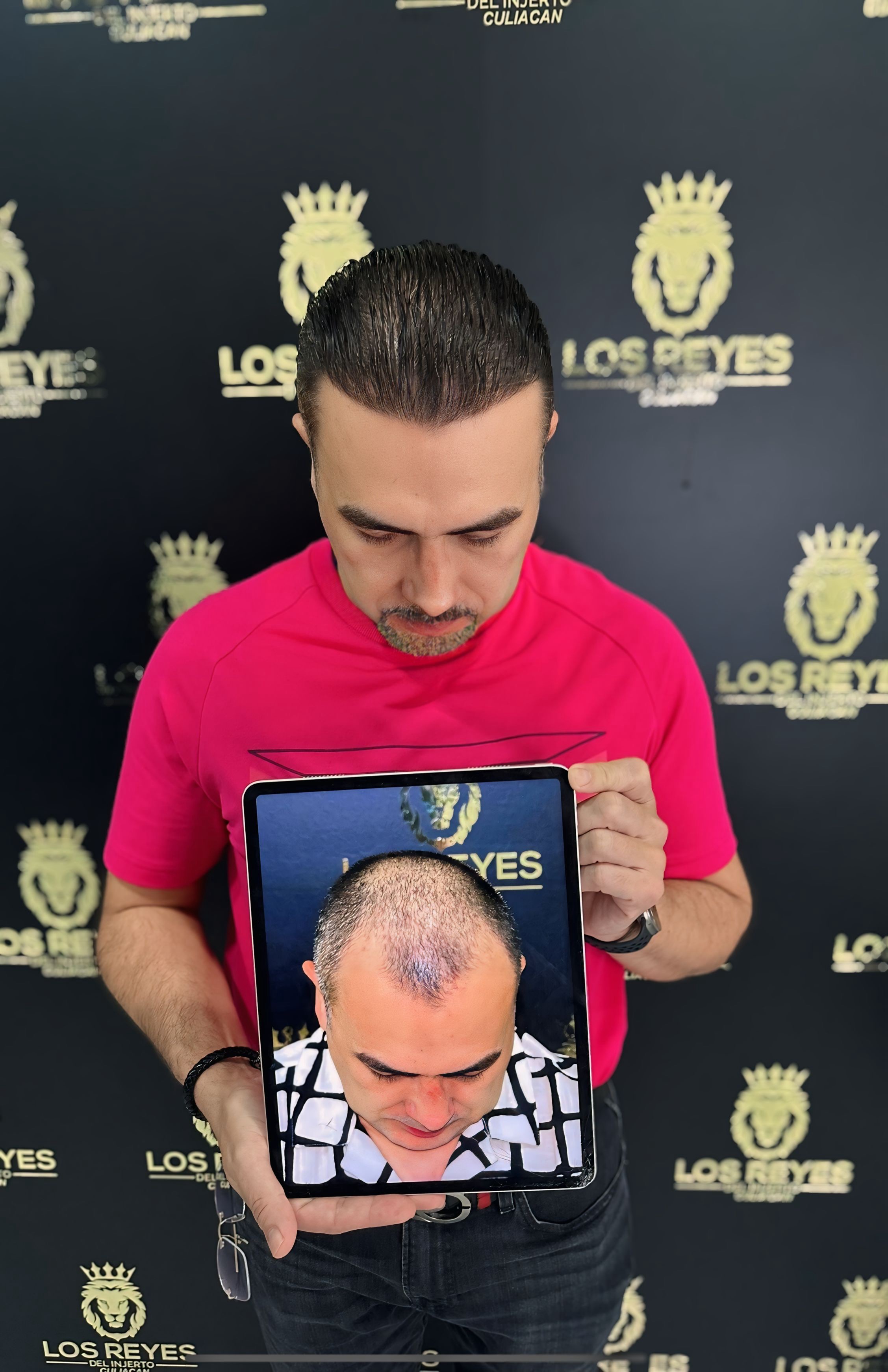 Nuestro equipo -Los Reyes del Injerto MX