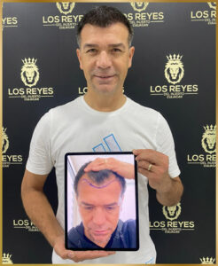 Los Reyes del Injerto