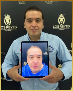 Los Reyes del Injerto